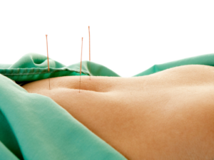 Acupuncture Points for Abdominal Pain - Dr. Alexander Heyne